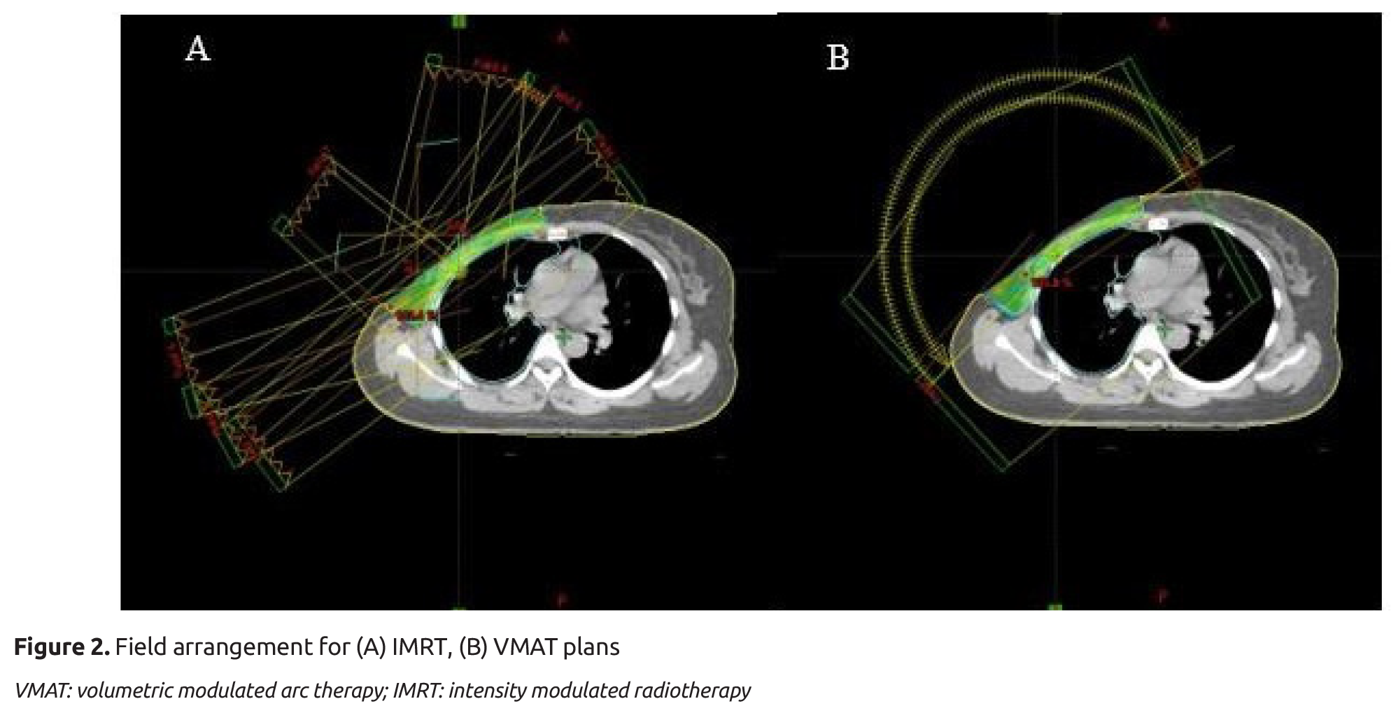 A Dosimetric Comparison of Volumetric Modulated Arc Therapy and ...