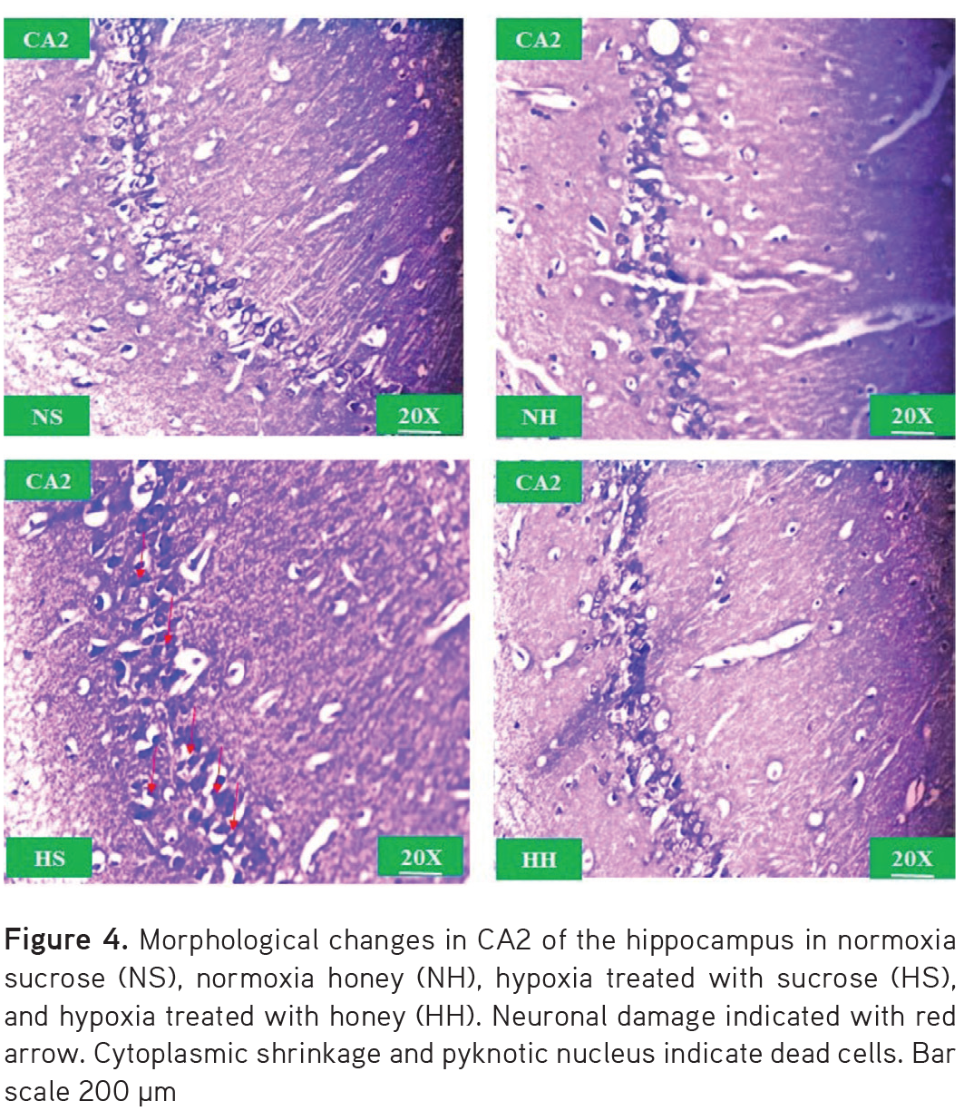 Tualang Honey Ameliorates Hypoxia-induced Memory Deficits by Reducing ...