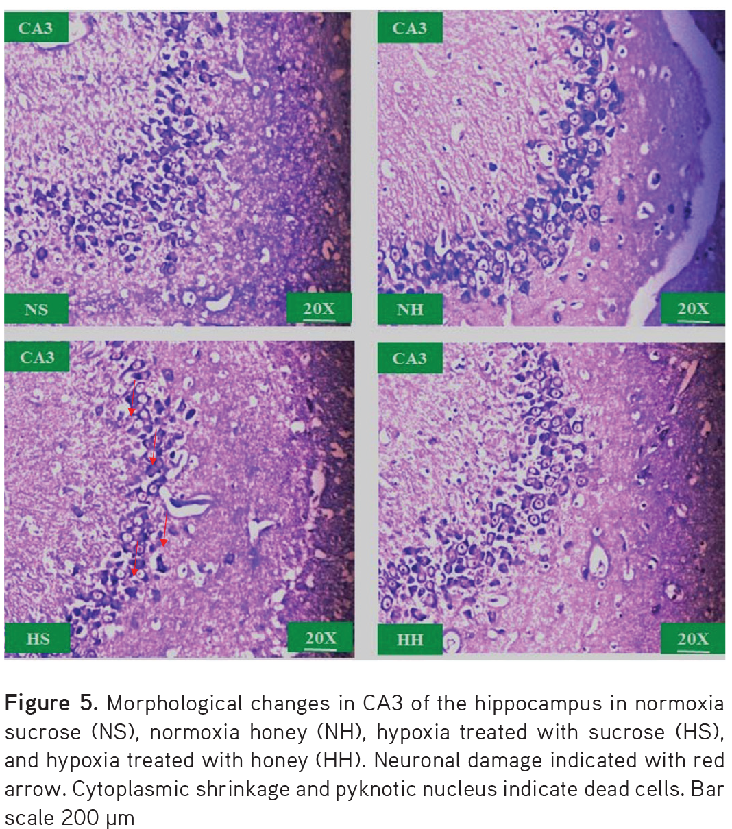 Tualang Honey Ameliorates Hypoxia-induced Memory Deficits by Reducing ...