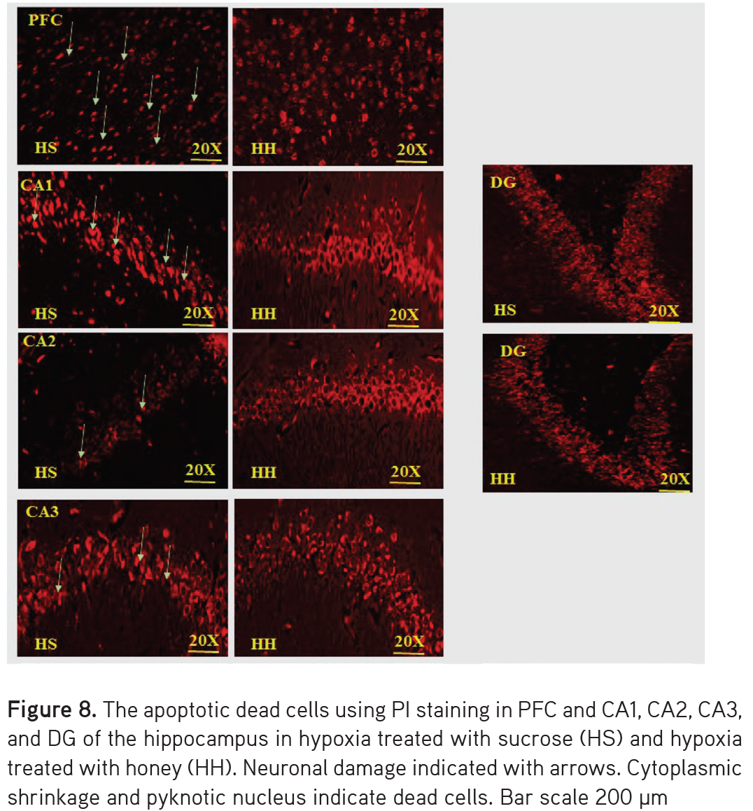 Tualang Honey Ameliorates Hypoxia-induced Memory Deficits by Reducing ...