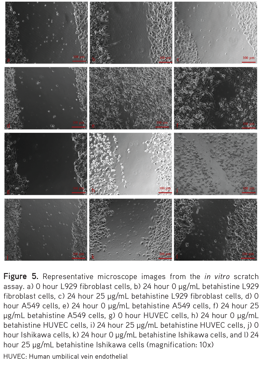 In Vitro Physiological Effects of Betahistine on Cell Lines of Various ...