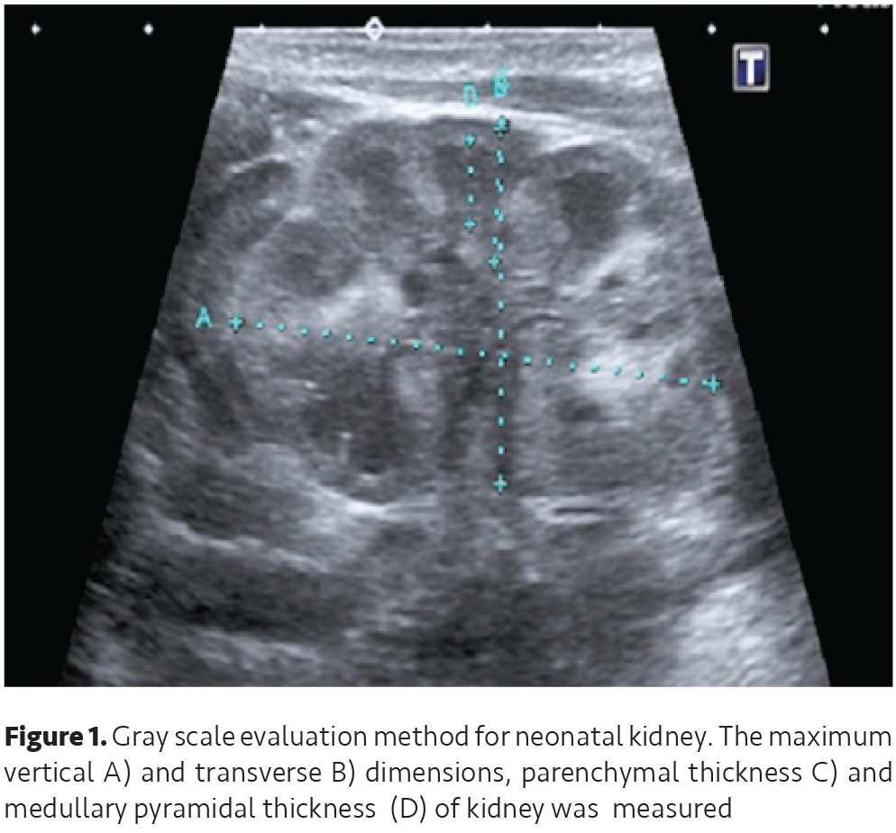 Neonatal Kidney Dimensions and Medullary Pyramid Thicknesses According ...