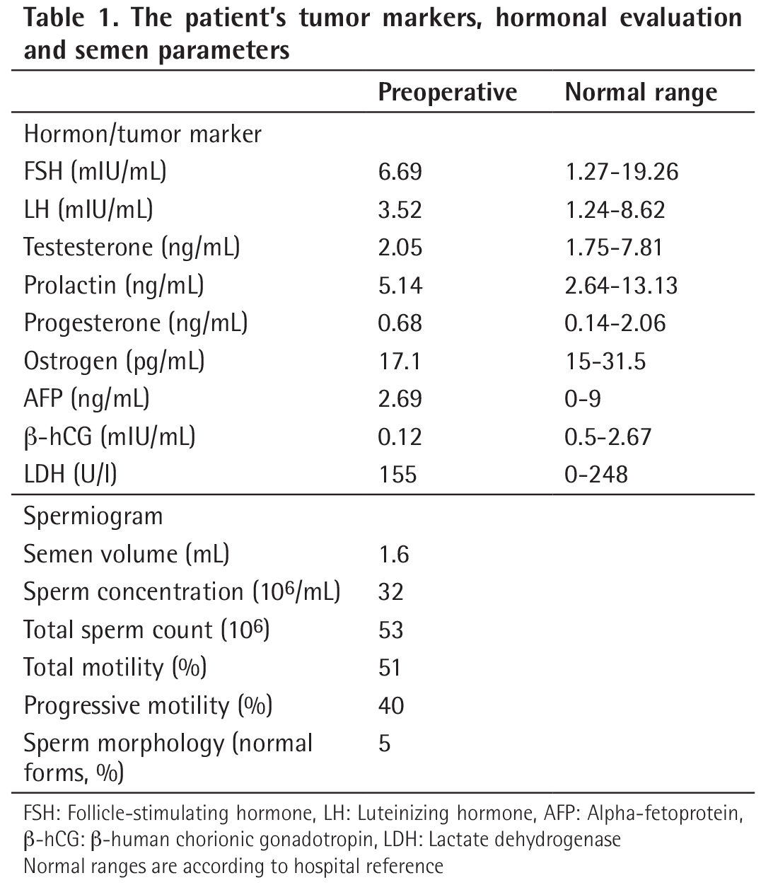 Leydig Cell Tumor Of The Testis A Case With Incidental Diagnosis