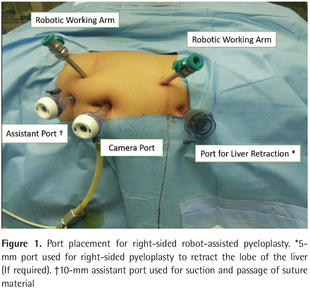 Comparison of Surgical and Functional Outcome of Laparoscopic ...