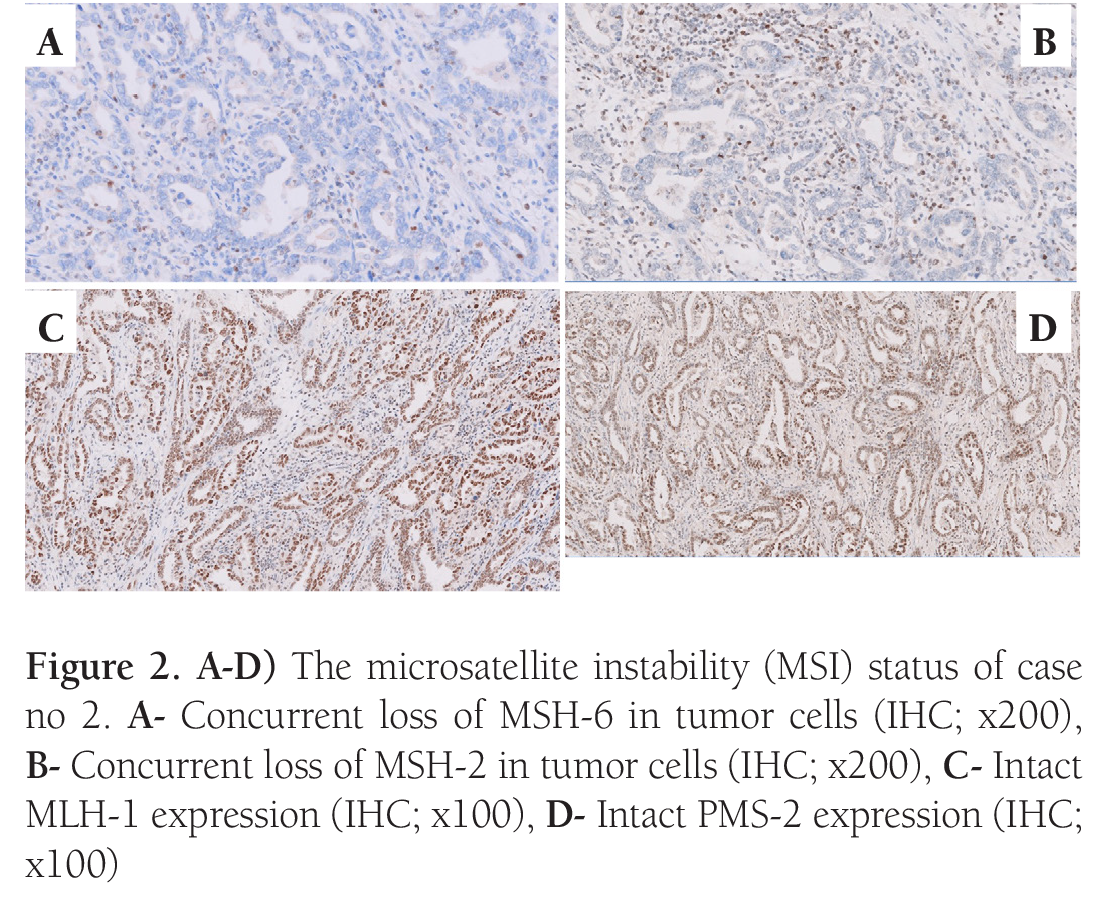 Clear cell carcinoma of the uterine cervix; an unusual HPV-independent tumor ...
